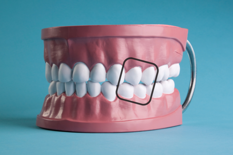 Tipos de dientes y sus funciones - Simon Blas